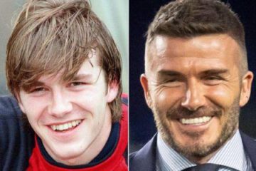 David Beckham With Veneers - BakaBuzz